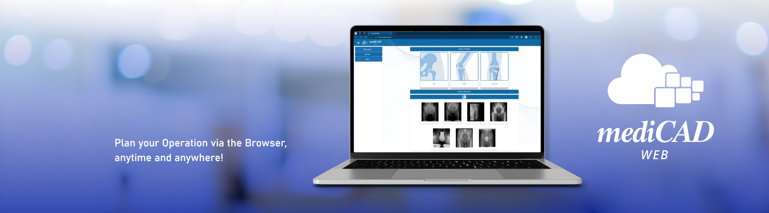 Landingpage - Contact free Web Trial - mediCAD